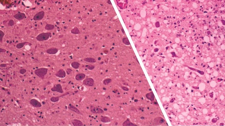 Outdoor Illinois Journal: Legend or Reality: Breaking the code of CWD myths